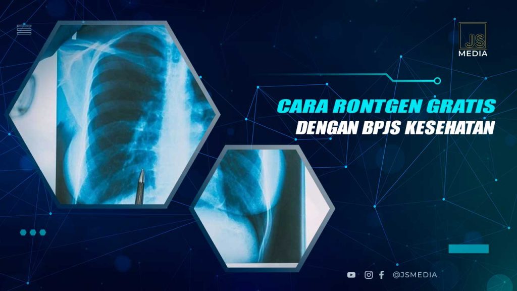 Cara Agar Biaya Rontgen Ditanggung BPJS Kesehatan